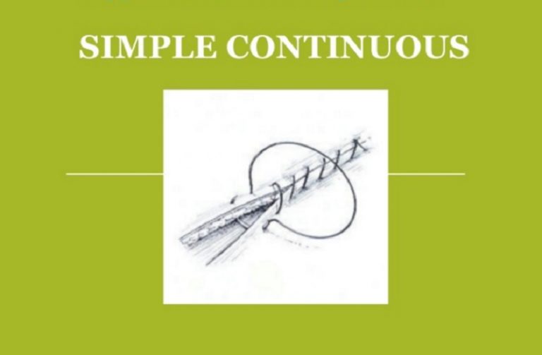 Simple Continuous Suture Pattern