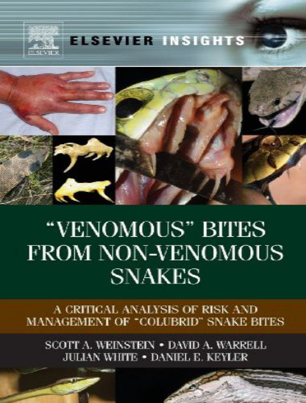 "Venomous” Bites from Non-Venomous Snakes 1st Edition