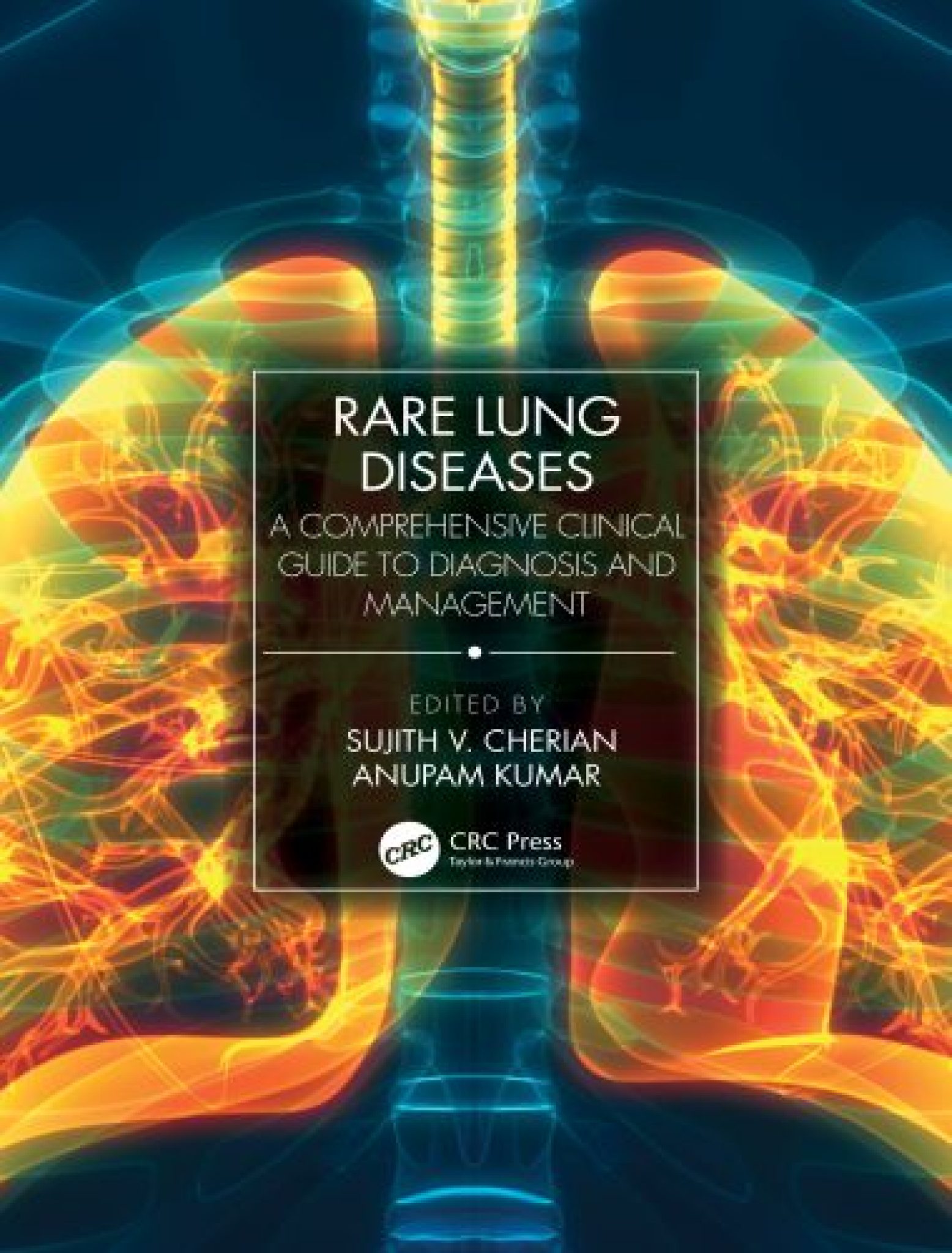 Rare Lung Diseases: A Comprehensive Clinical Guide to Diagnosis and ...